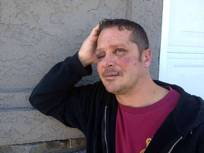 Beating victim speaks out – Brandon Sun