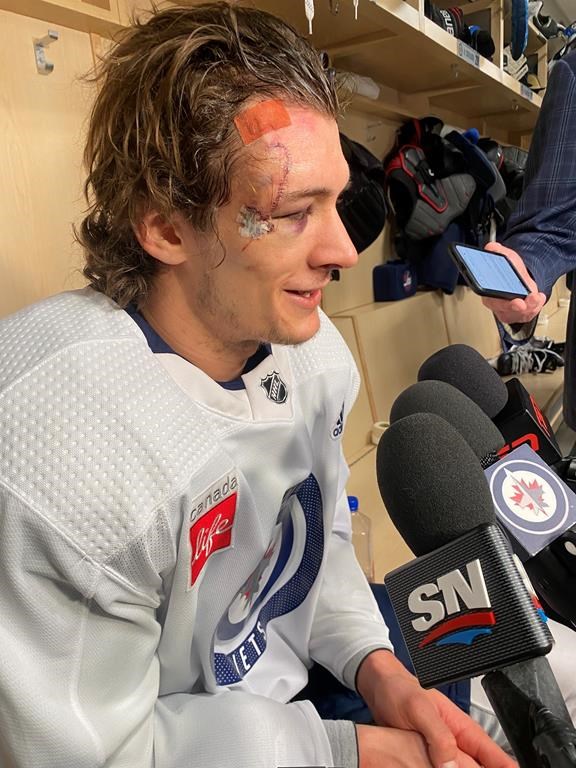 Jets forward Barron weighs in on recovery after taking skate to the ...